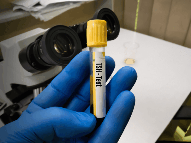 TSH Levels: Symptoms, Causes, and When to Test